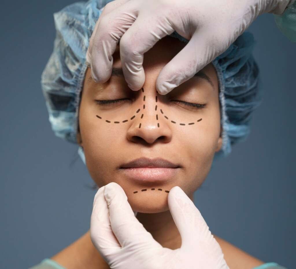 Ethnic Rhinoplasty in Turkey: Preserving Natural Beauty with Expert ...